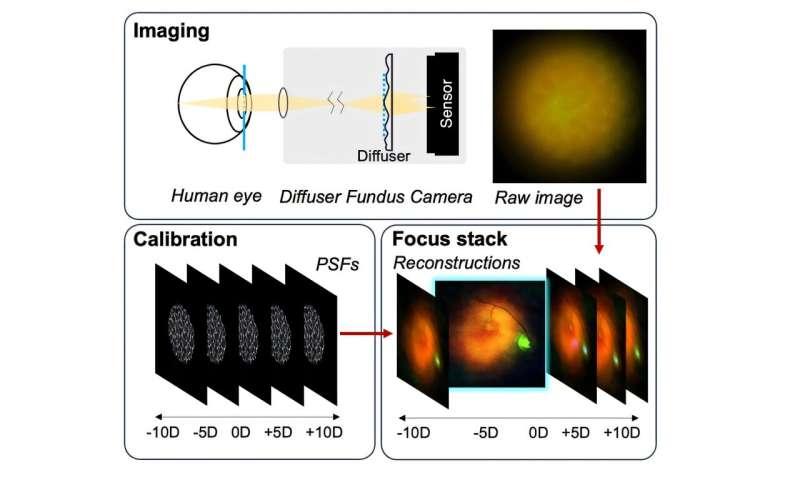 World’s first spiral IOL now available