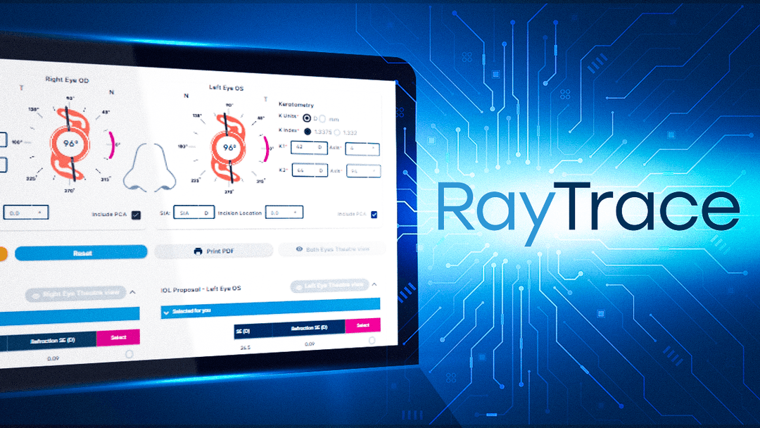 Rayner Introduces RayTrace 4.0 IOL Calculation Tool