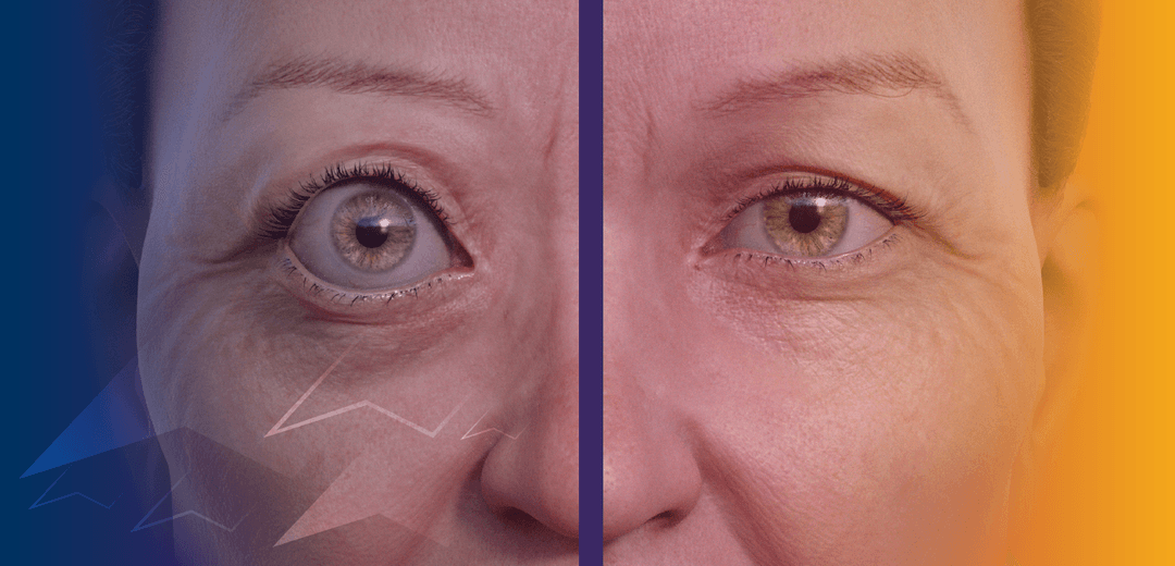 Ocugen completes enrollment in liMeliGhT phase 3 trial of OCU400 for ...